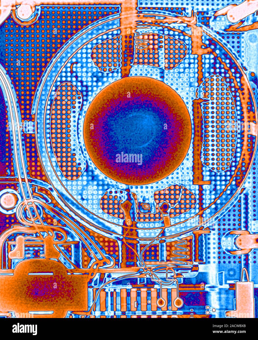 Radio speaker, coloured X-ray Stock Photo - Alamy