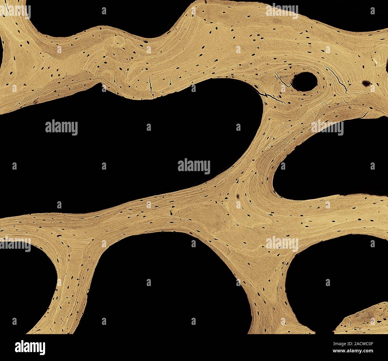 False-coloured Scanning Electron Micrograph of a cross-section through ...