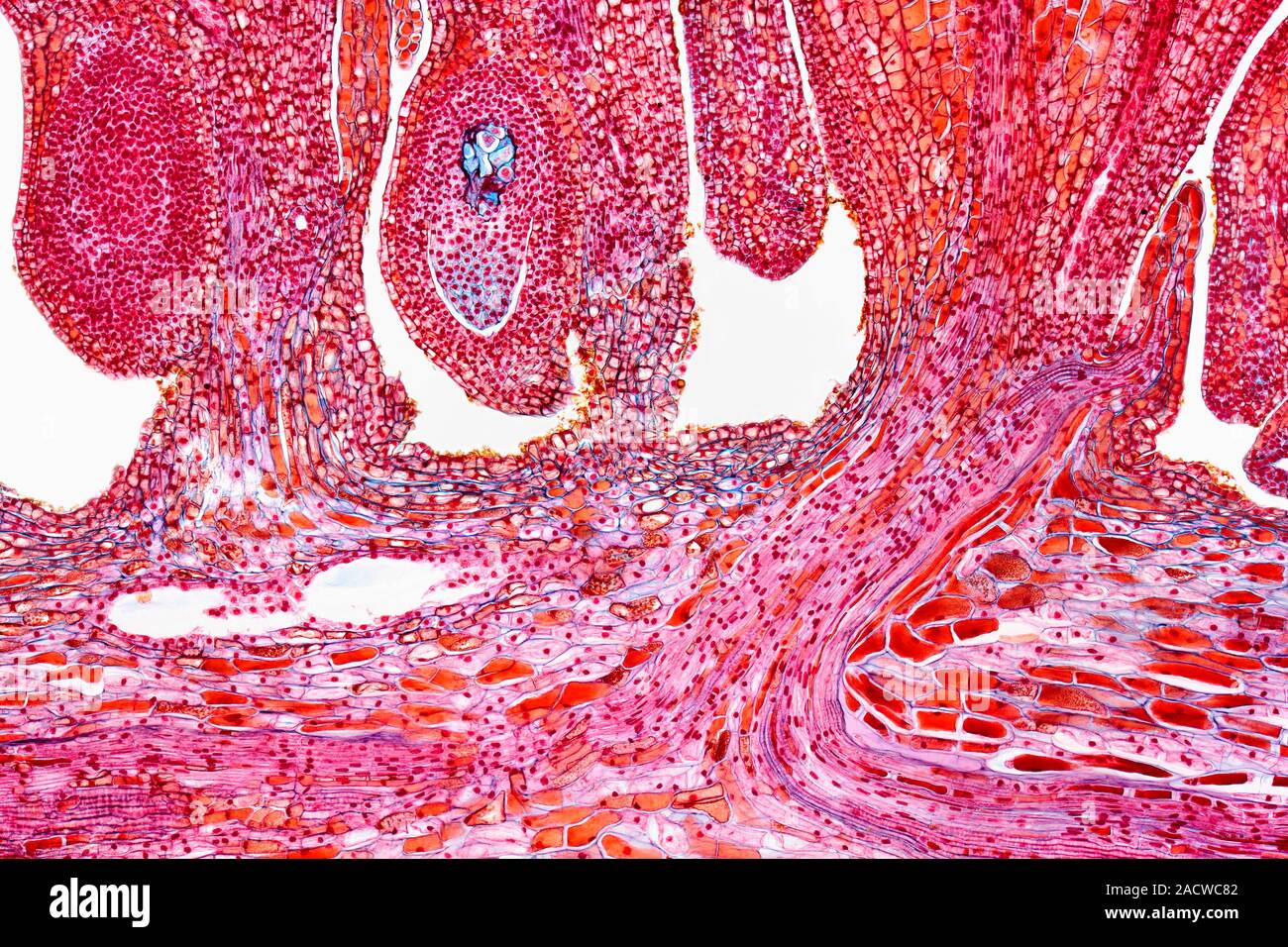 Pine cone. Light micrograph of a section through part of a female cone ...