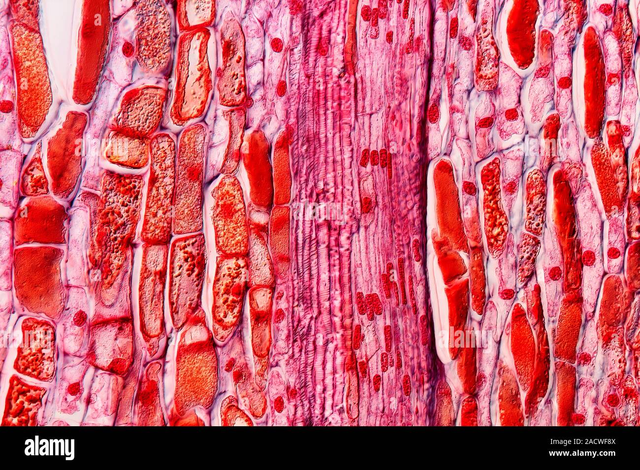 Pine cone tissue. Light micrograph of a section through a female cone ...