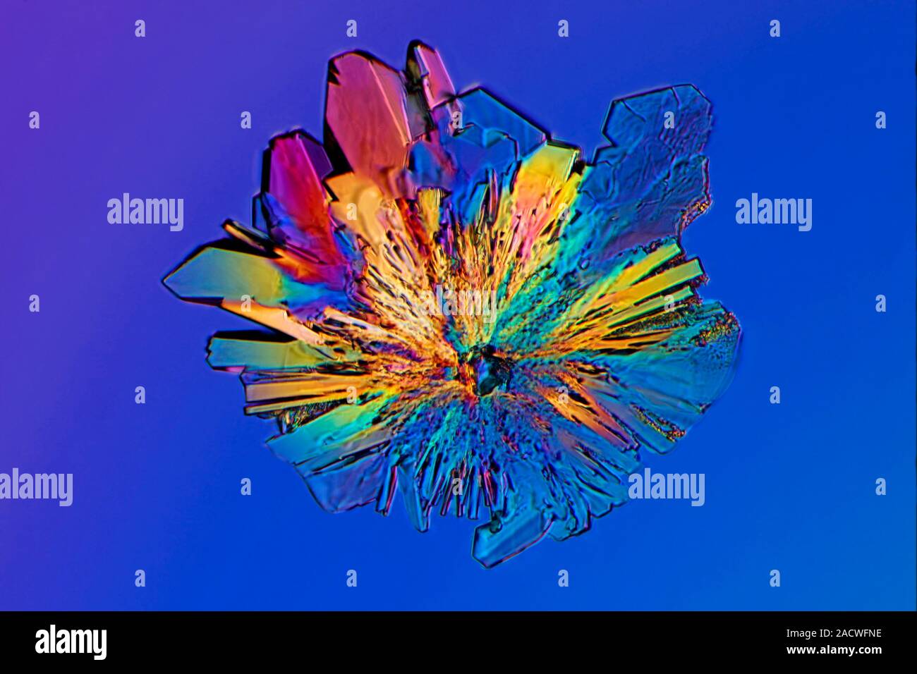 Cysteine crystal. Polarized light micrograph of a spherulite (spherical ...