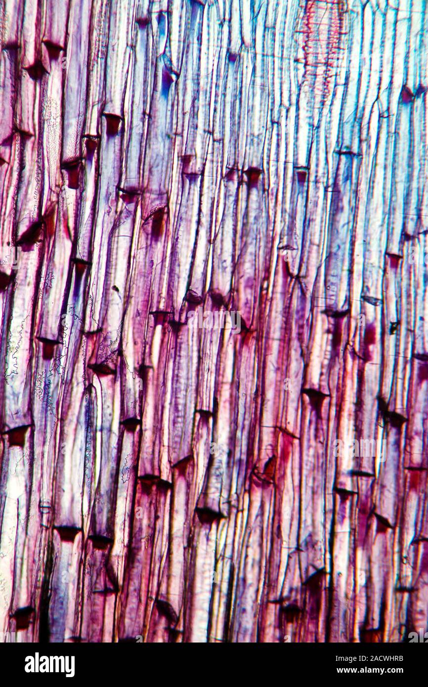 Squash stem. Light micrograph of a longitudinal radial section through ...