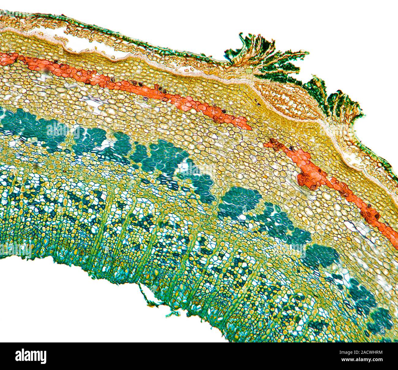 Lentil plant stem. Light micrograph of a section through the stem of a ...