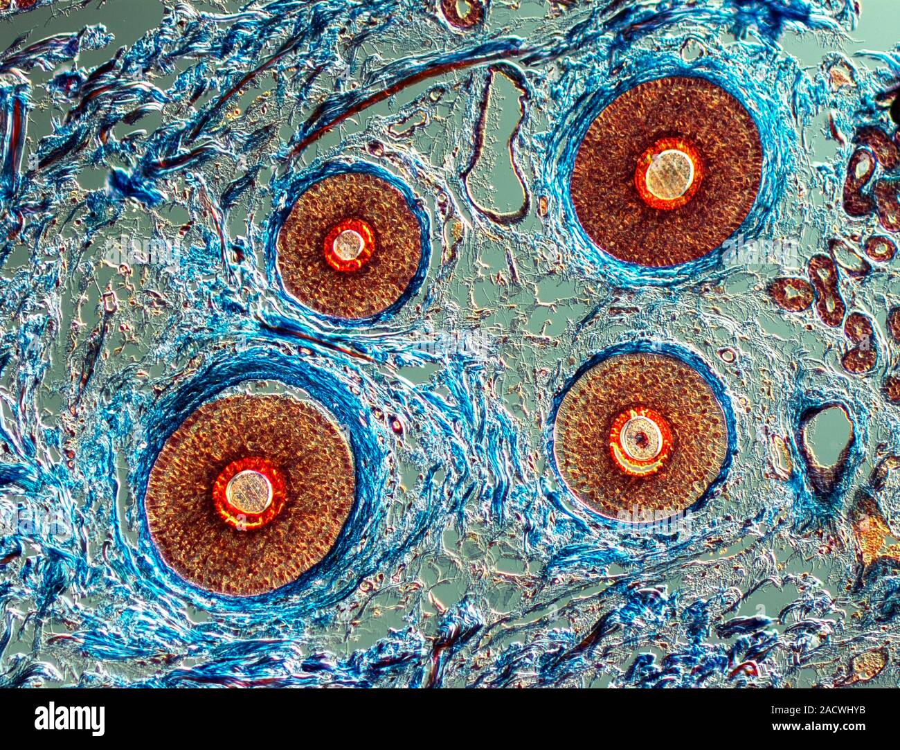 Skin section. Light micrograph of a section through the dermis of the ...