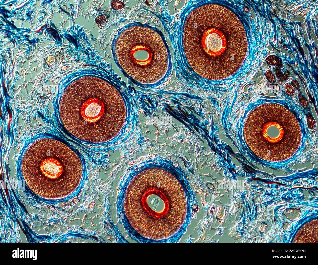 Skin section. Light micrograph of a section through the dermis of the ...