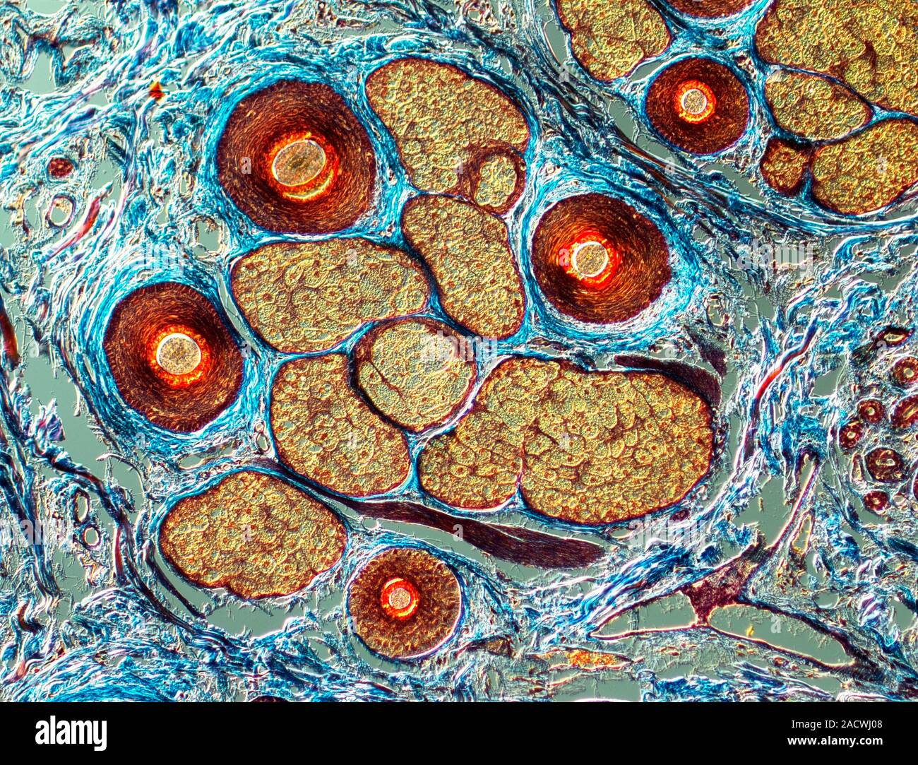 Skin section. Light micrograph of a section through the dermis of the ...