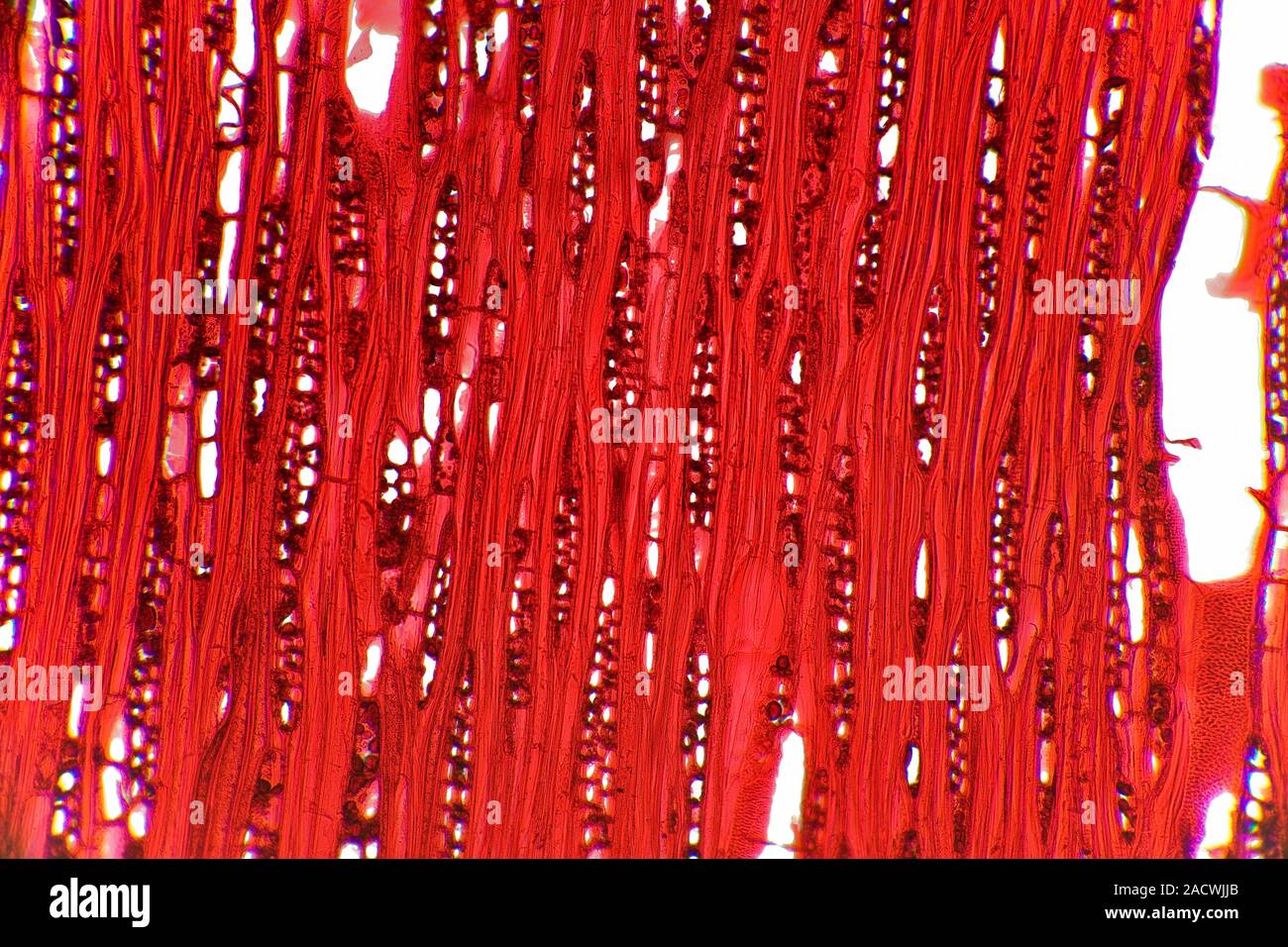Palaquium obovatum stem. Light micrograph of a tangential longitudinal ...