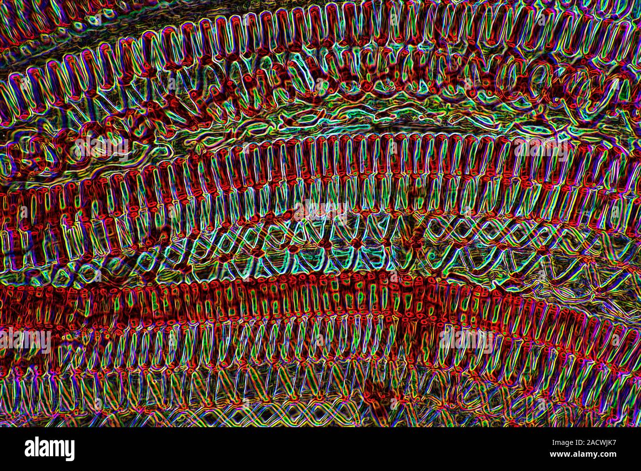 Plant vascular bundles. Light micrograph of a section through vascular ...