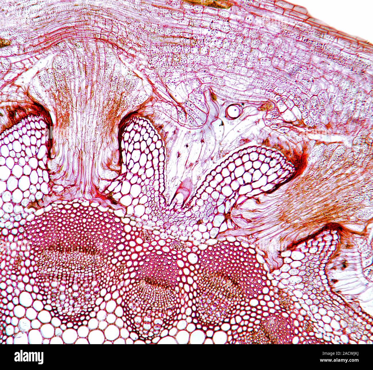 Parasitic plant stem. Light micrograph of a section through the stem of ...