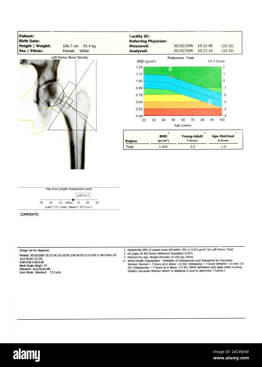 Bone density scan. Results from a DEXA (dual energy X-ray ...