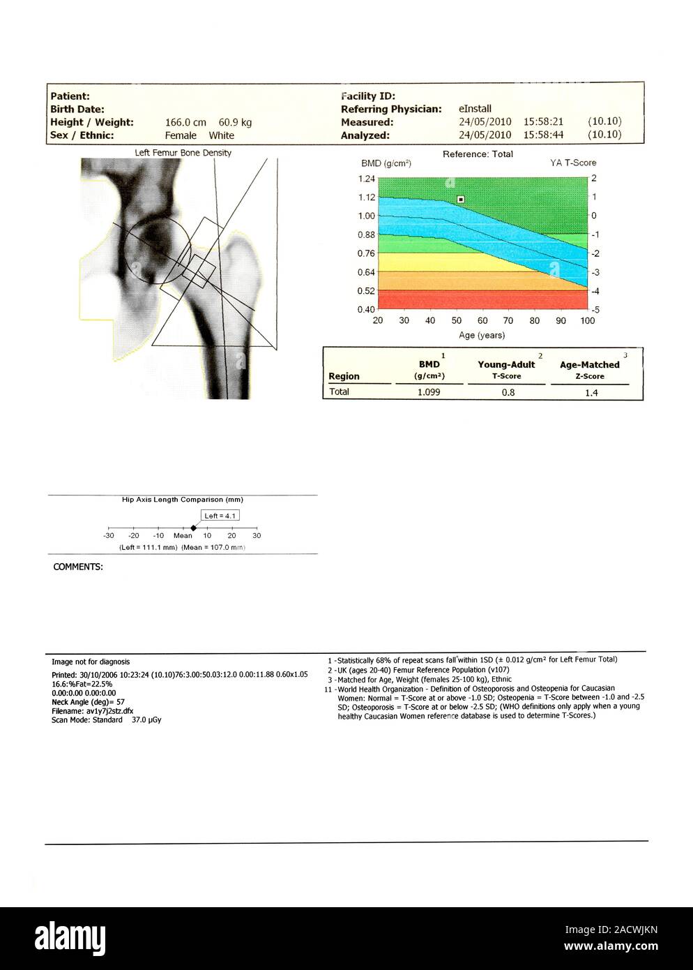 Bone Density Scan Results From A Dexa Dual Energy X Ray