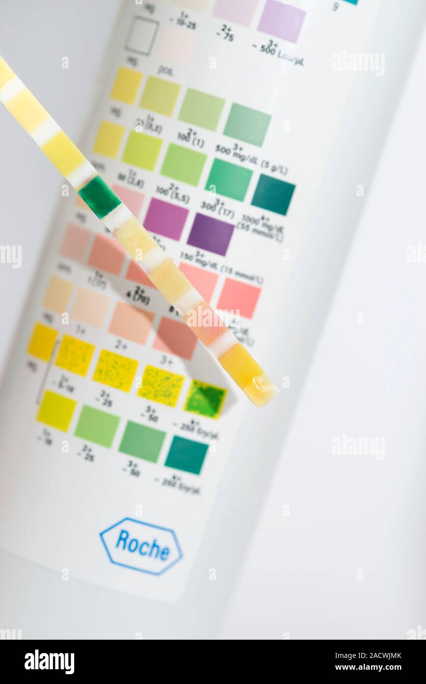 Urine Dipstick Template