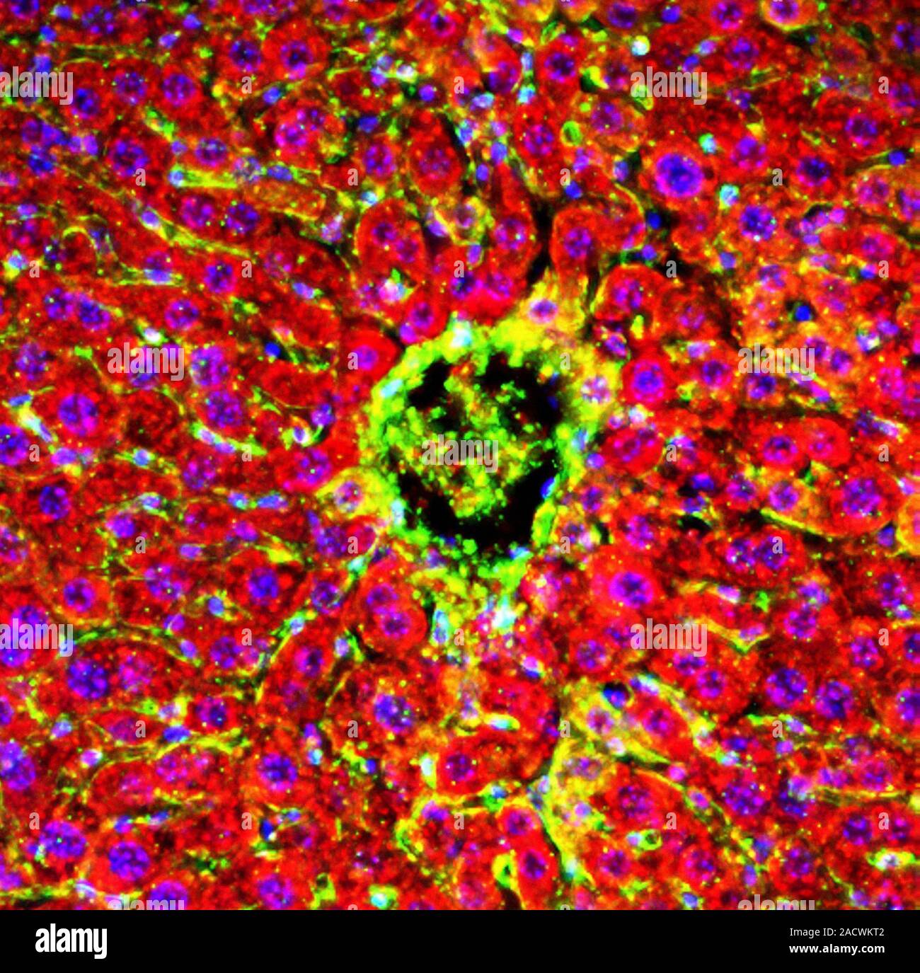 Liver Vein Fluorescence Deconvolution Micrograph Of A Section Through Liver Tissue Around A