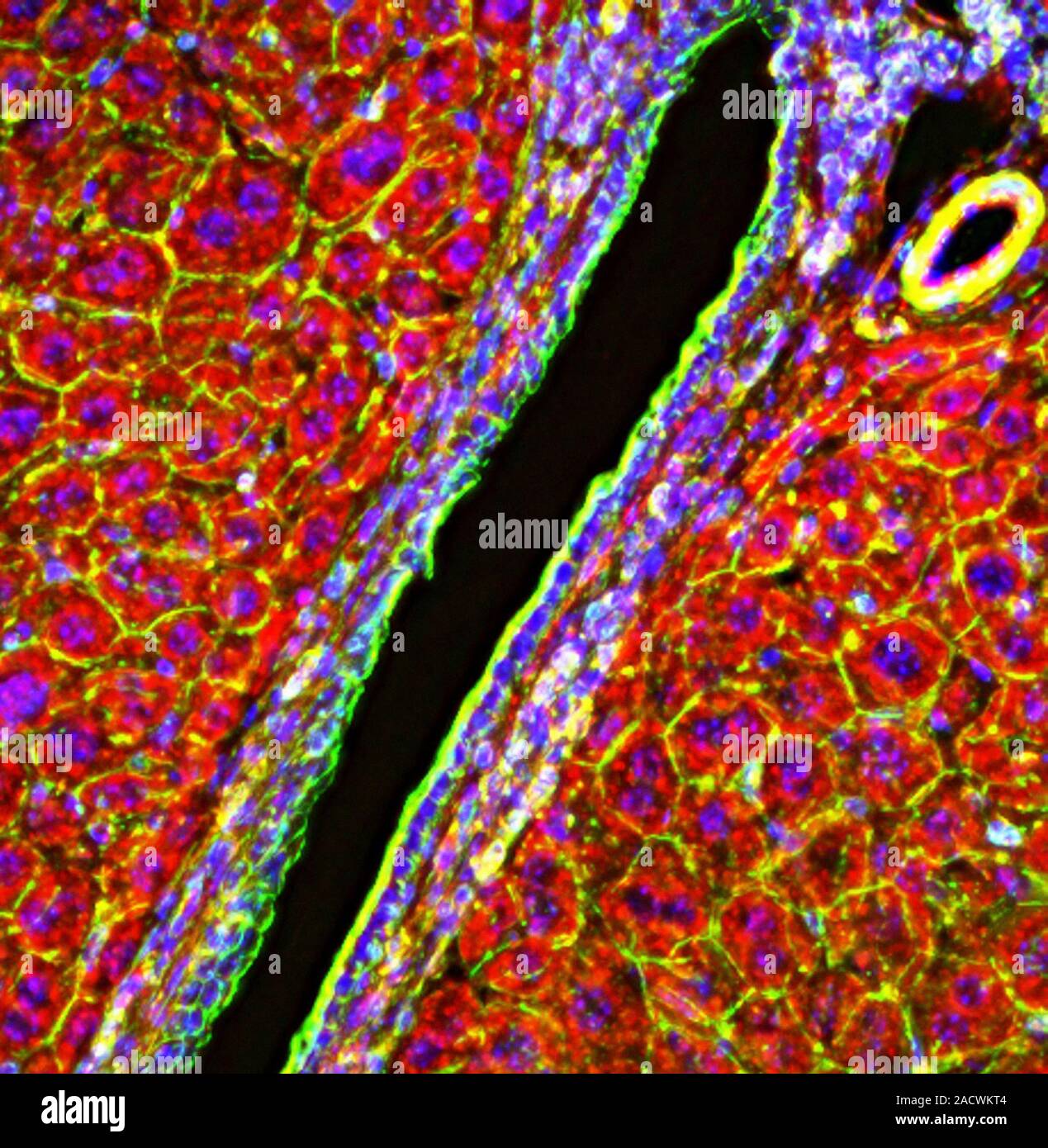 Liver Triad Fluorescence Deconvolution Micrograph Of A Section Through Liver Tissue Showing A