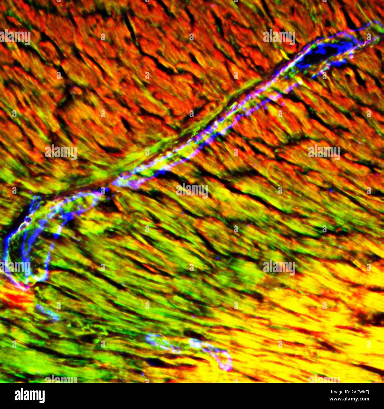 Heart arteriole. Fluorescence deconvolution micrograph of a section ...