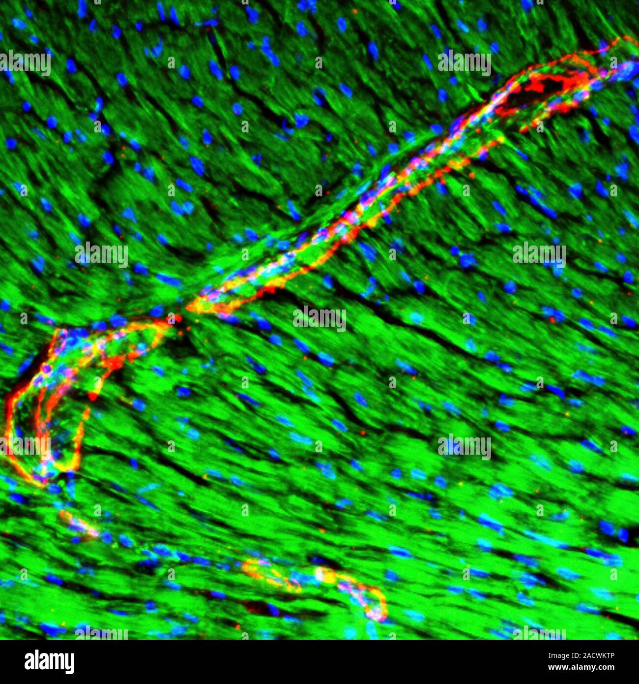 Heart arteriole. Fluorescence deconvolution micrograph of a section ...