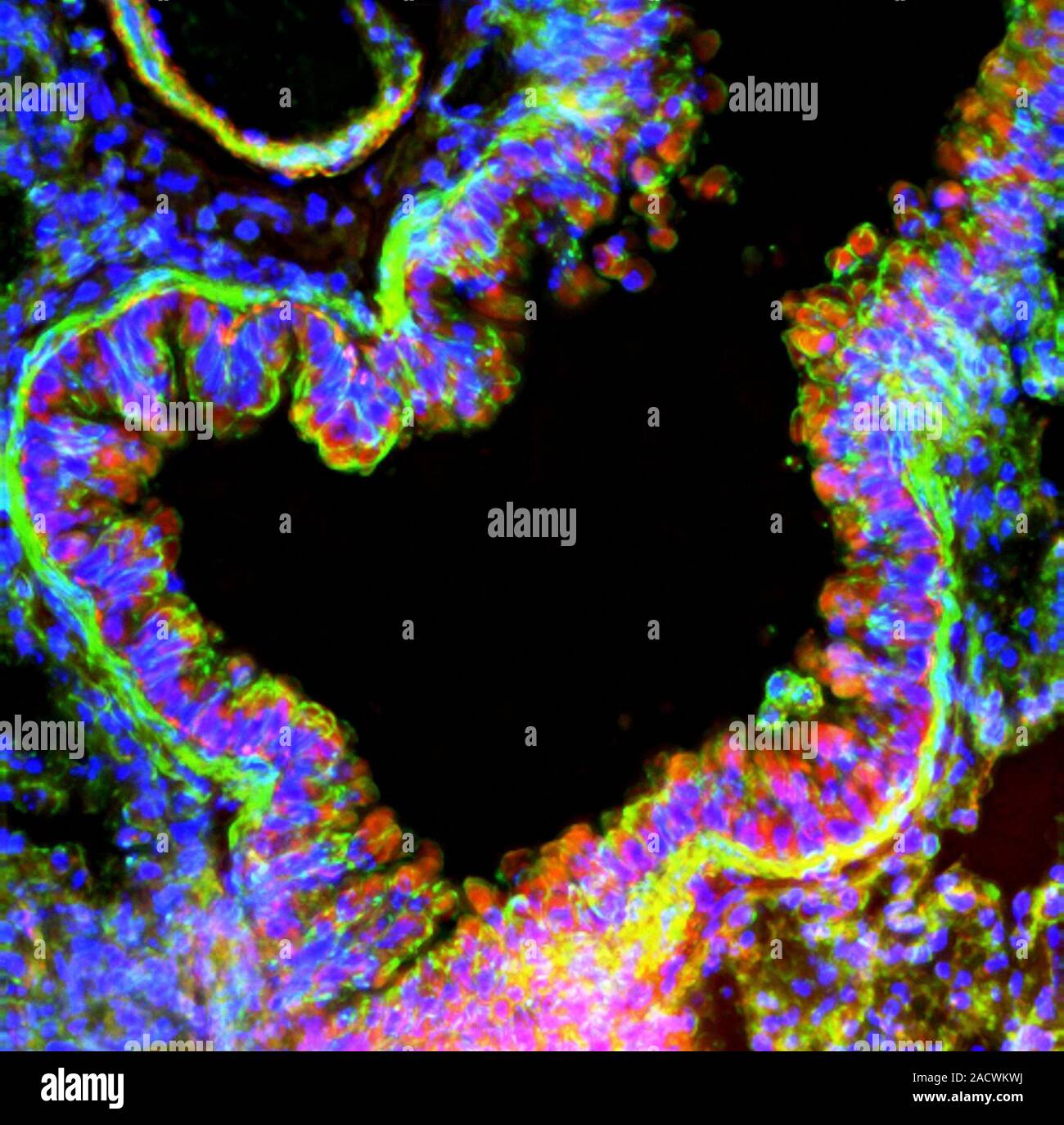 Lung bronchiole. Fluorescence deconvolution micrograph of a section ...
