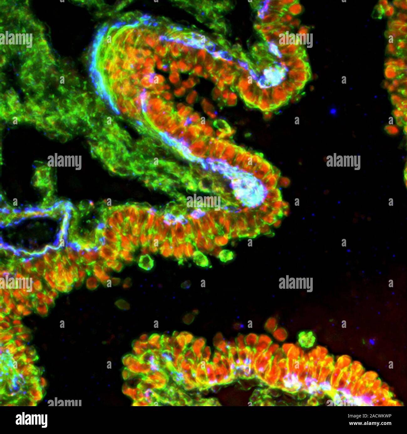Lung bronchiole. Fluorescence deconvolution micrograph of a section ...