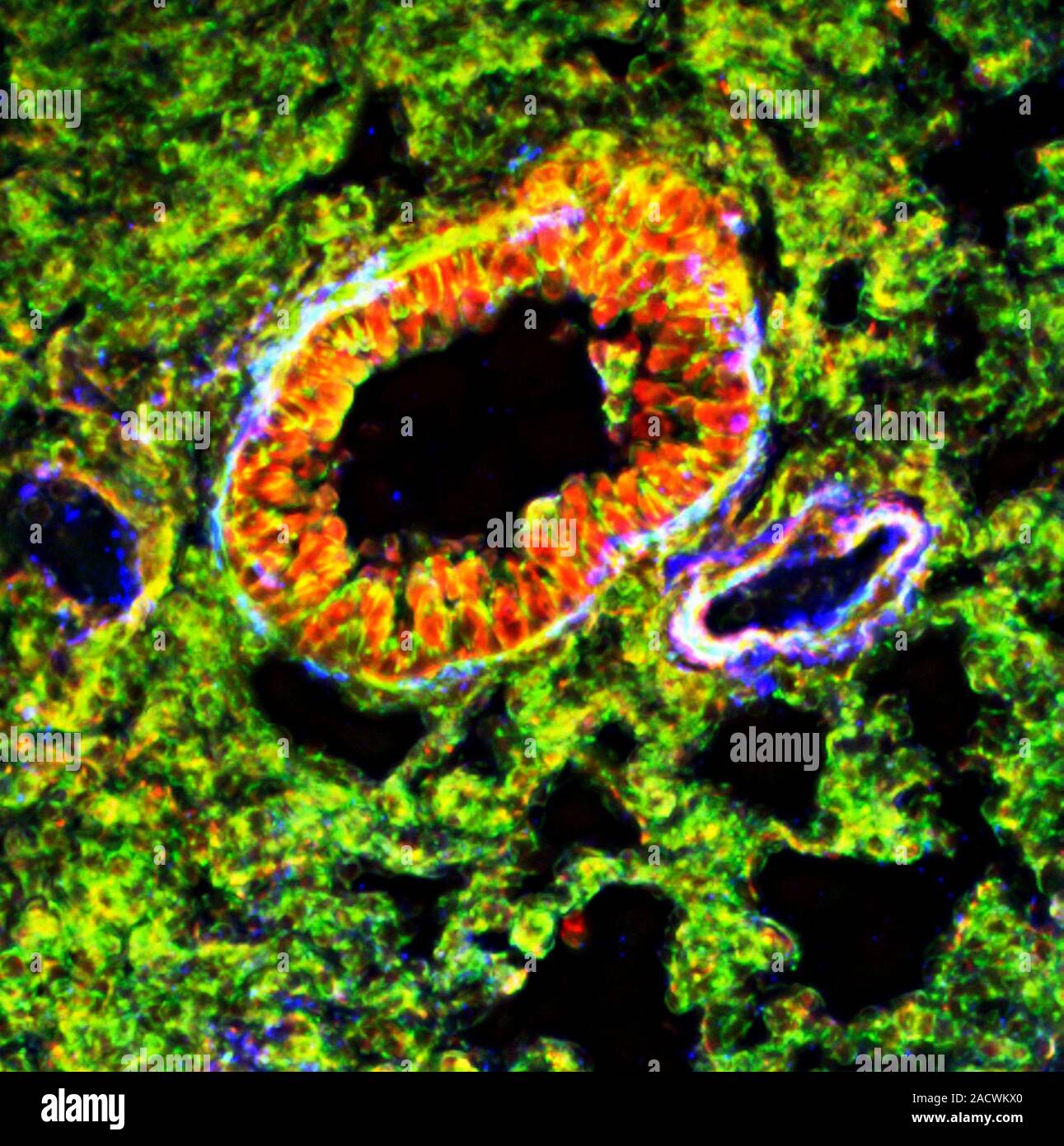 Lung bronchiole. Fluorescence deconvolution micrograph of a section ...