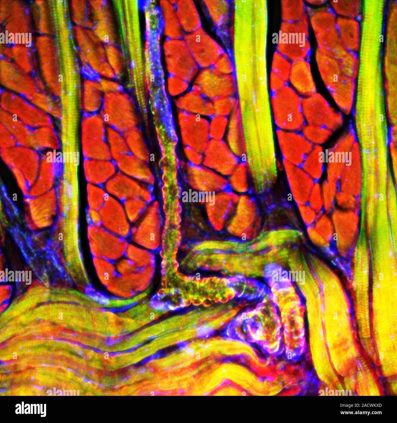 Tongue Tissue Fluorescence Deconvolution Micrograph Of A Section Through Tongue Tissue Showing