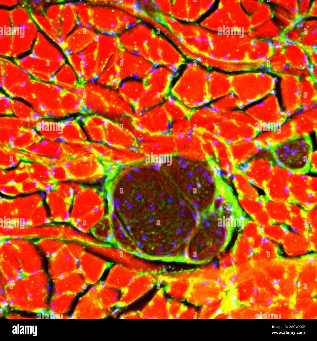 Tongue Tissue Fluorescence Deconvolution Micrograph Of A Section Through Tongue Tissue Showing