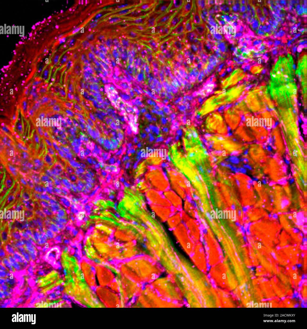 Tongue Tissue Fluorescence Deconvolution Micrograph Of A Section Through Tissue From The Dorsal