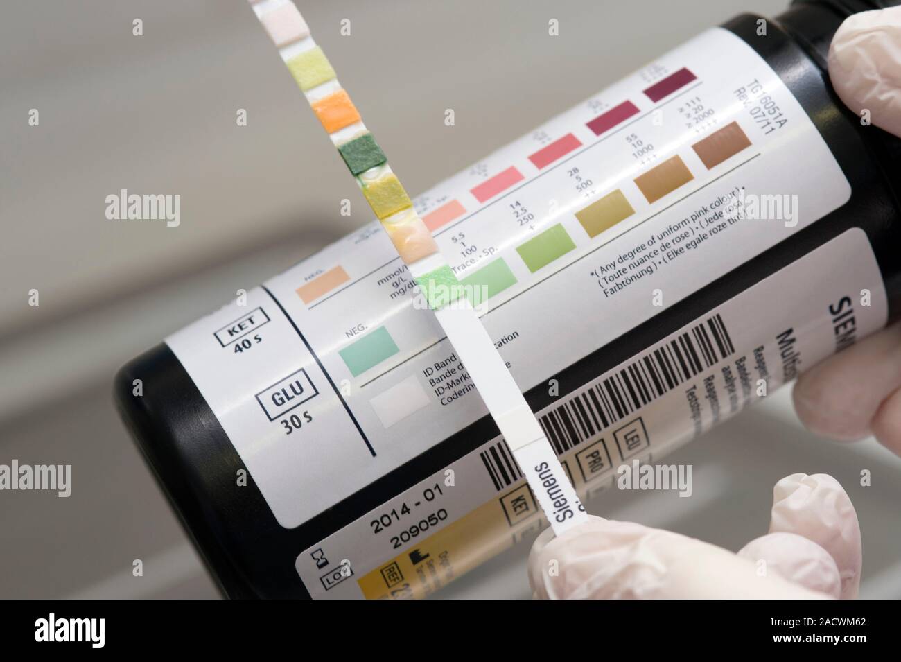 Urine test. Dipstick that has been placed in a sample of urine. The ...