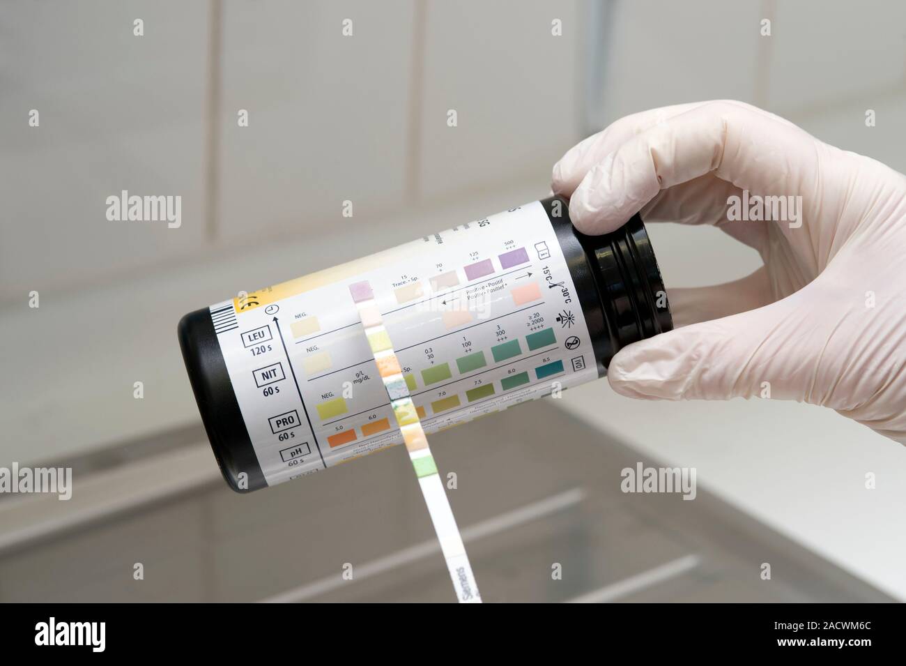 Urine test. Dipstick that has been placed in a sample of urine. The ...