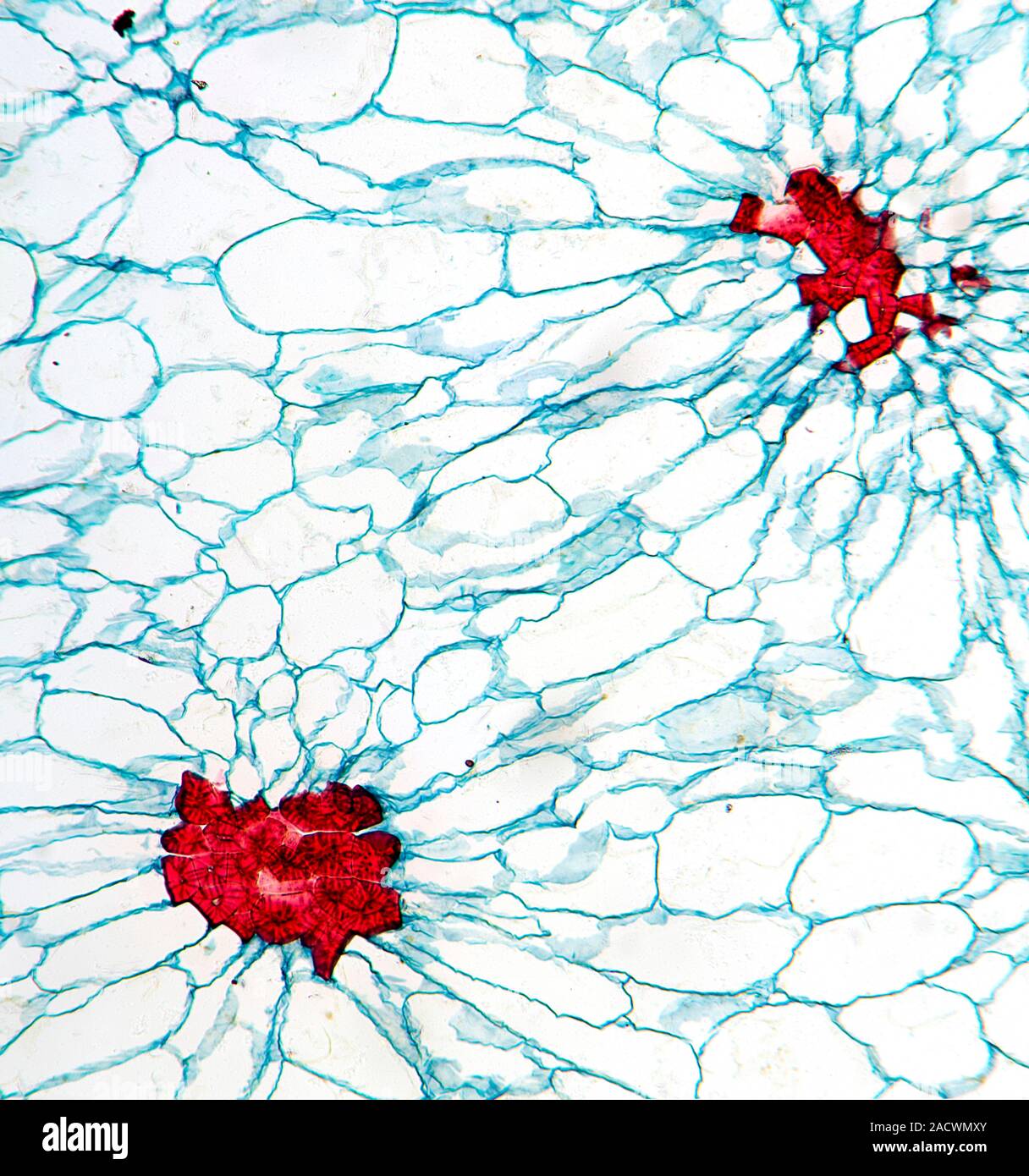 Pear fruit stone cells. Light micrograph of a longitudinal section ...