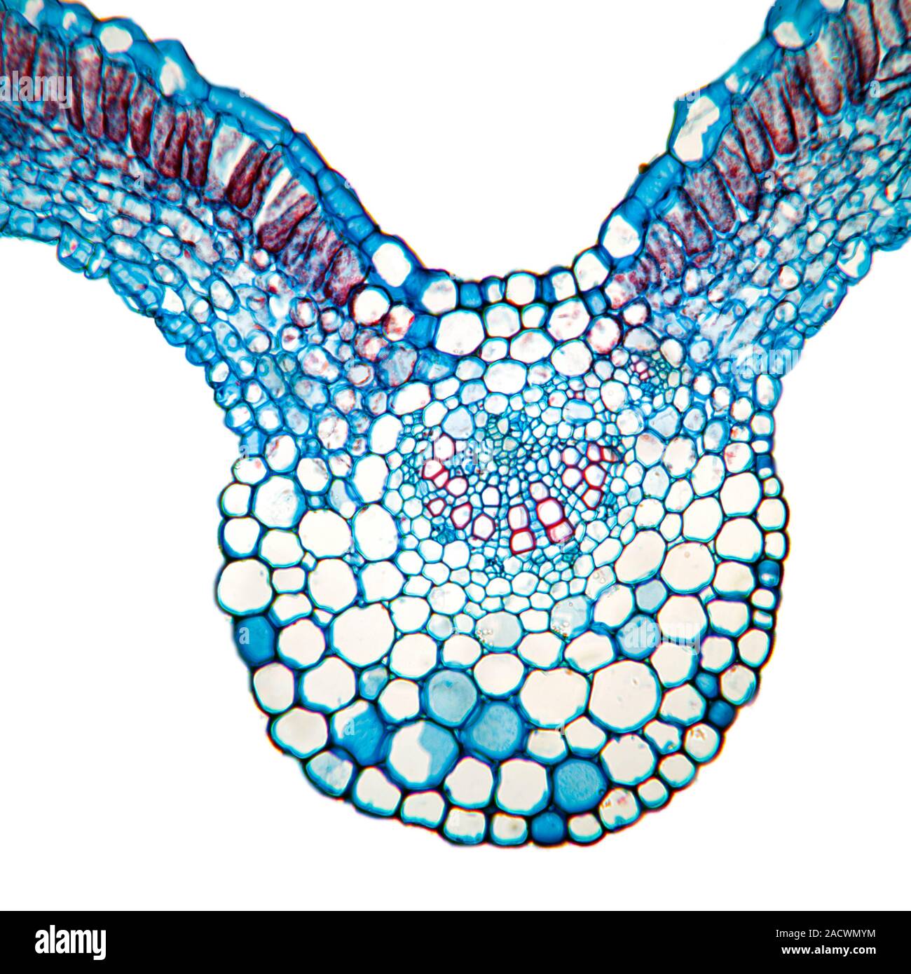 Virginia meadow-beauty leaf. Light micrograph of a section through the ...