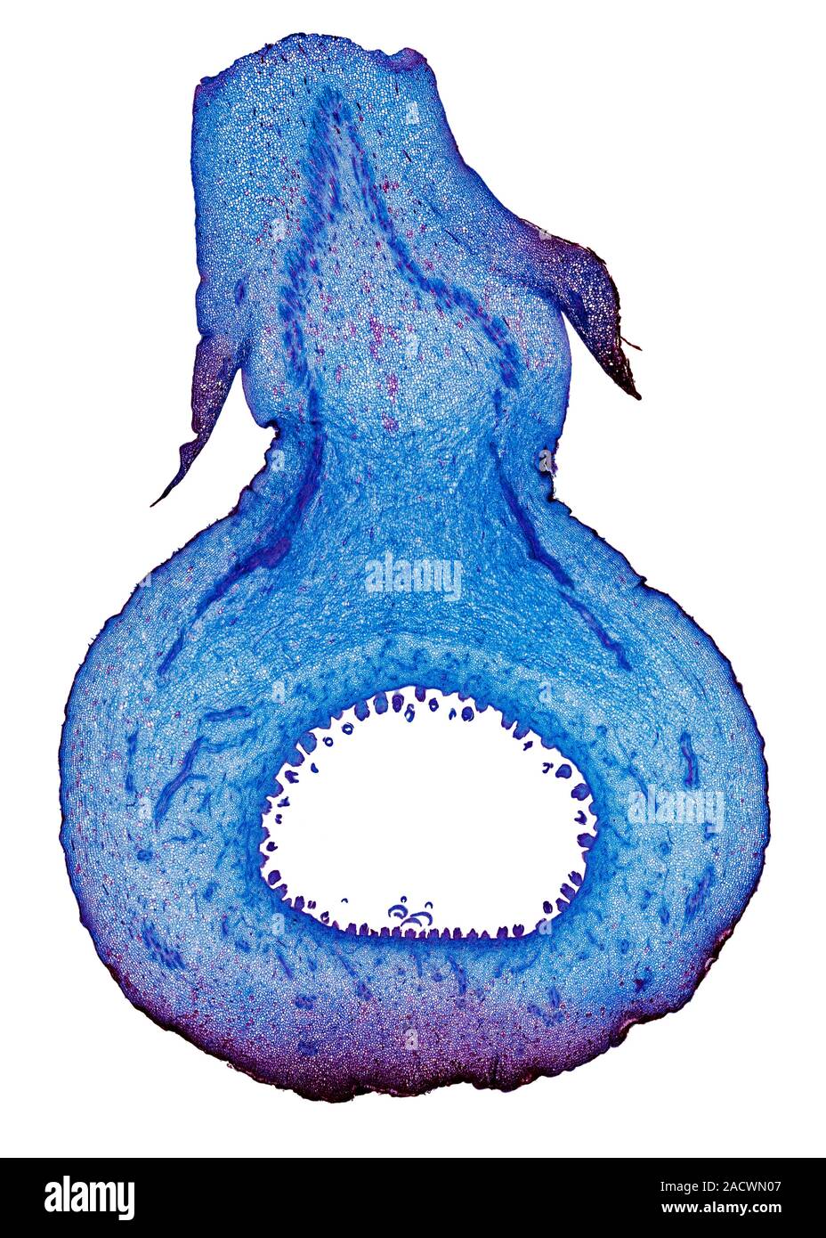 Fig fruit. Light micrograph of a section through a fig (Ficus carica ...