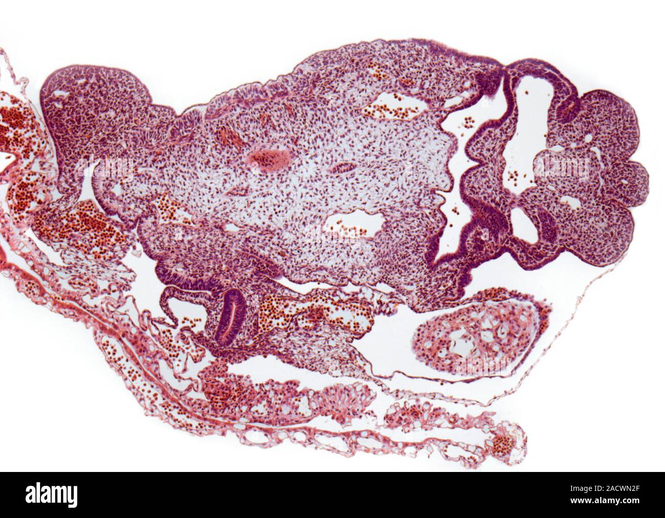 Miscarried embryo. Light micrograph of a section through a human embryo ...