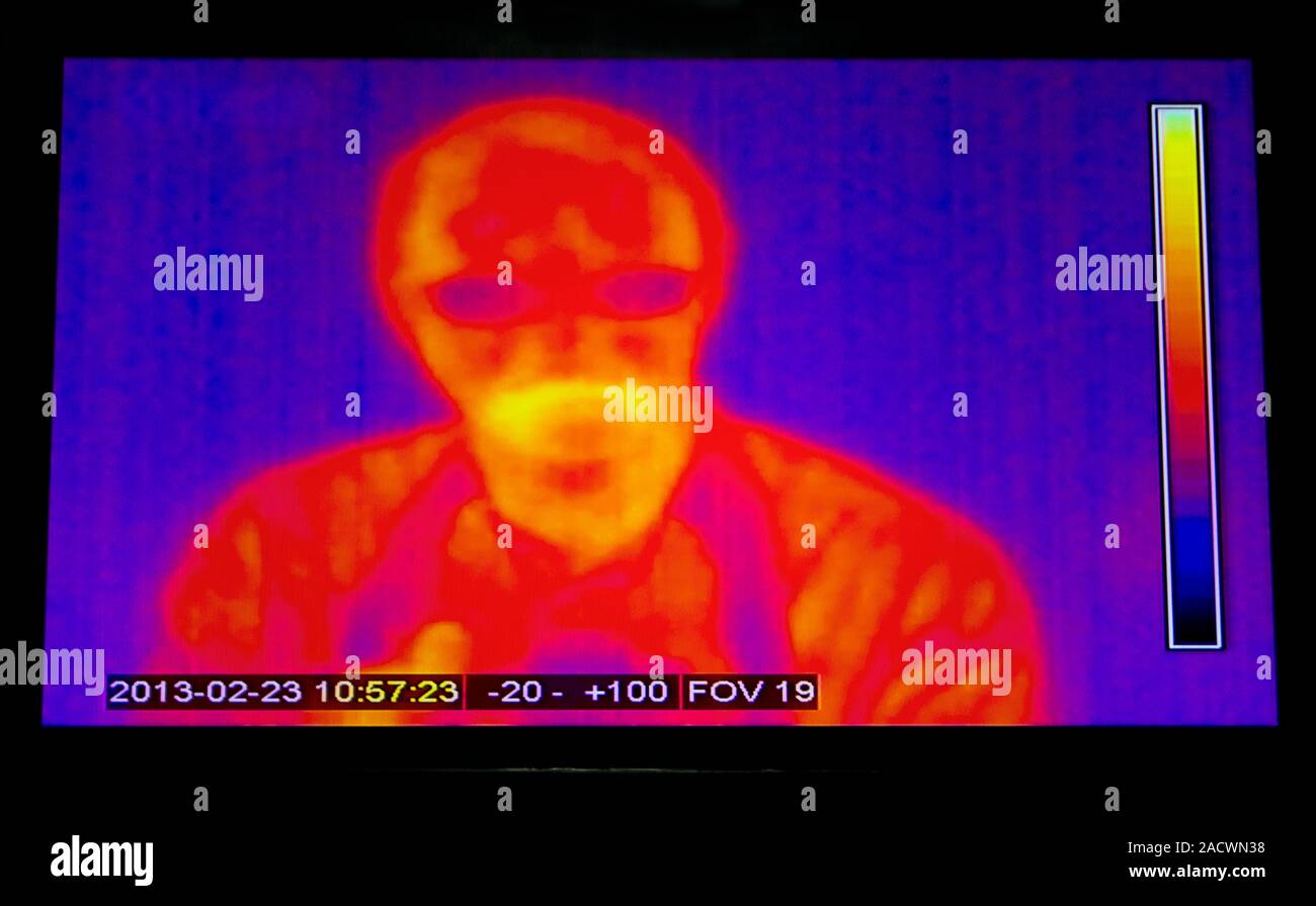 An image of a man's face produced by an infrared camera. Scale shows ...