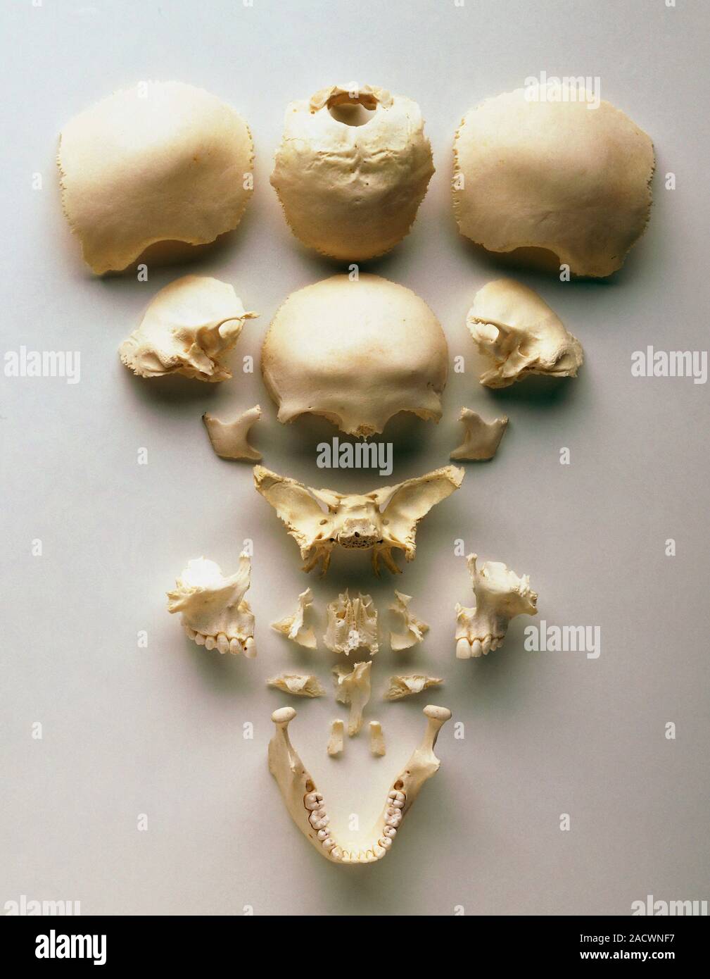 Human skull separated into its individual bones. At top left and top ...