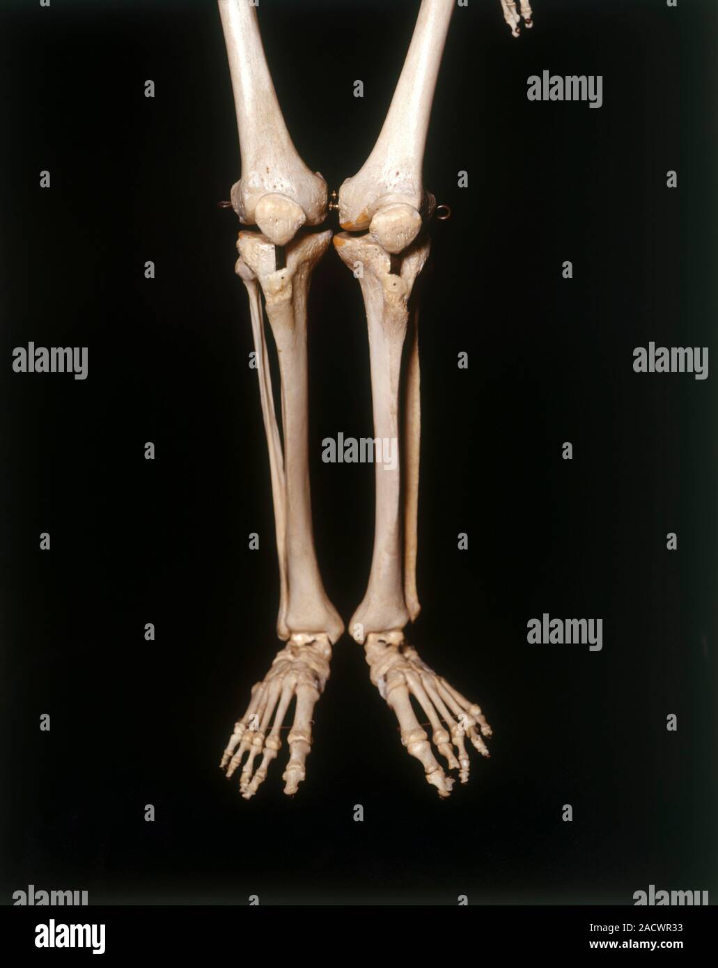 Human skeleton, legs and feet, front view, close up Stock Photo - Alamy