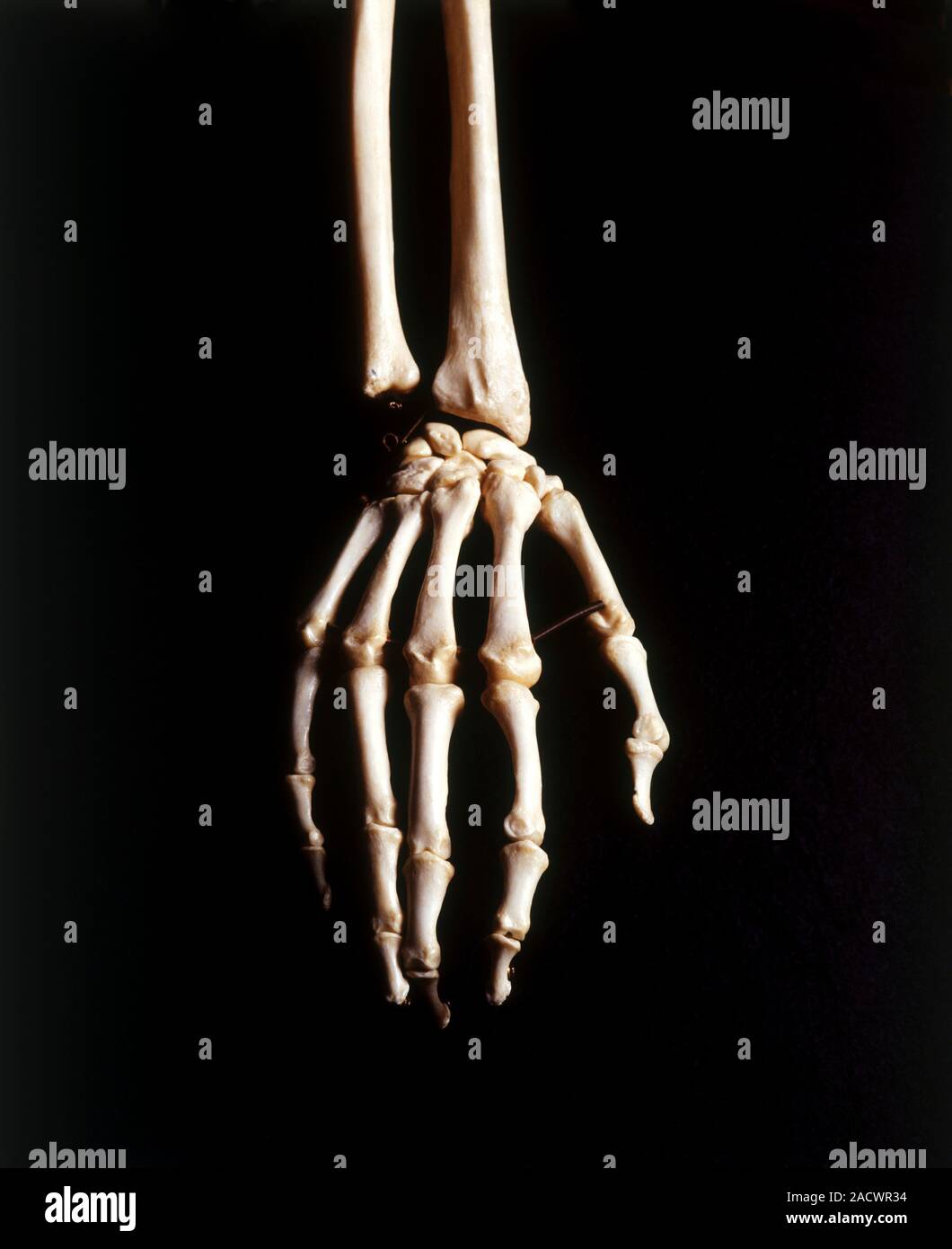 Human skeleton, hand and wrist bones, close up, view from above Stock ...
