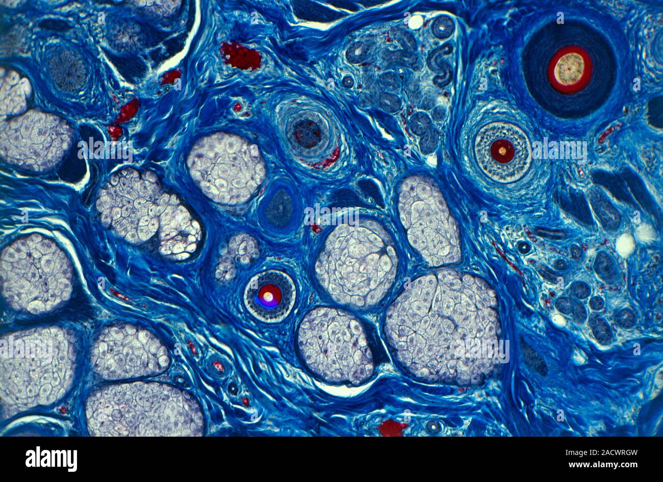 Human skin seen under a microscope, showing hair shaft and sweat pores ...