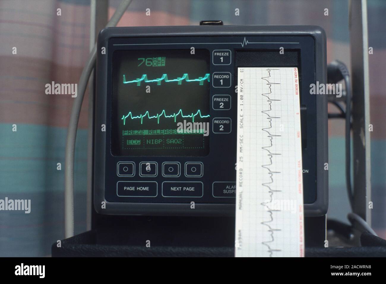 ECG monitor with printout coming out, close-up Stock Photo - Alamy