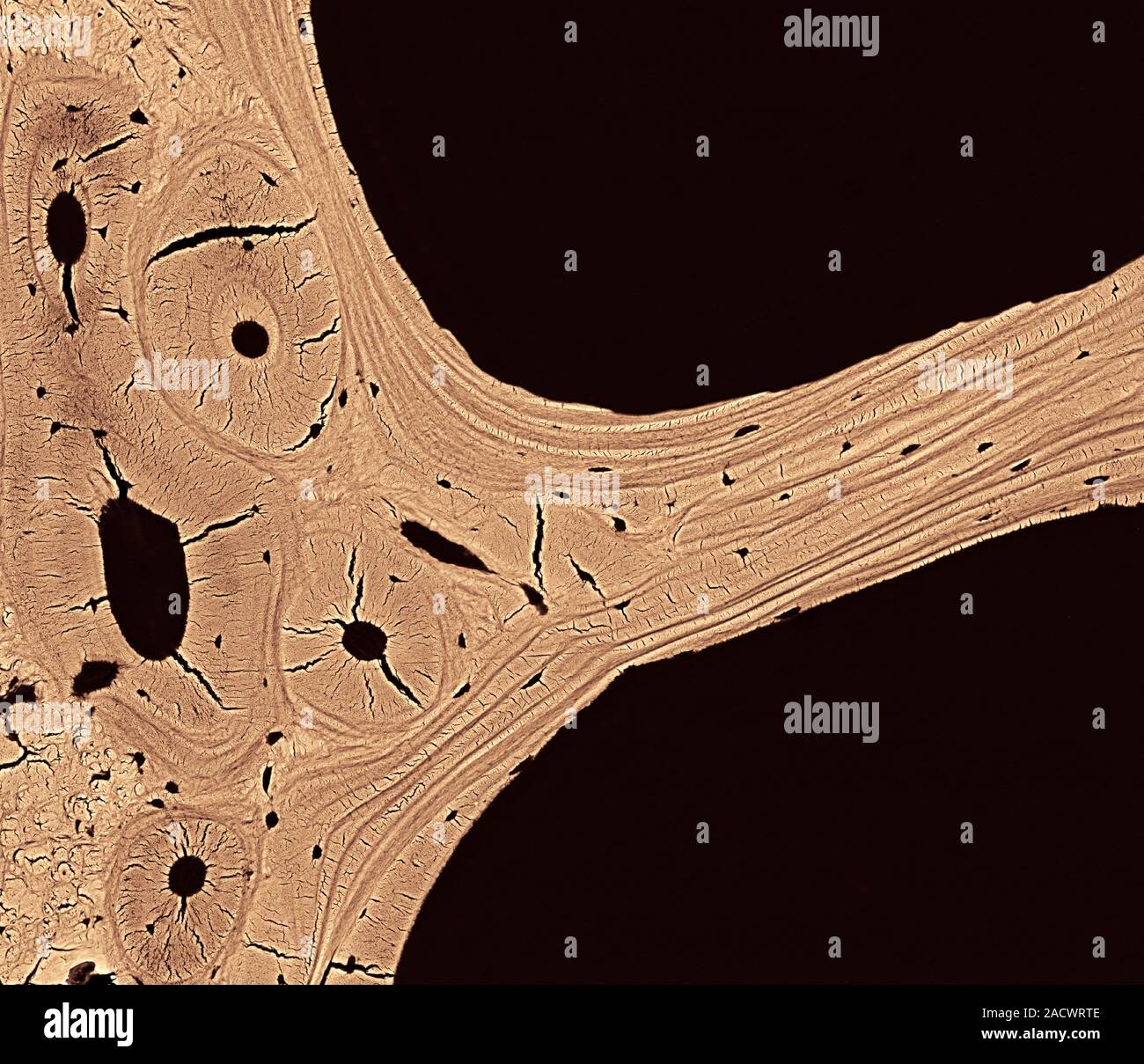 False-coloured Scanning Electron Micrograph of a cross-section through ...