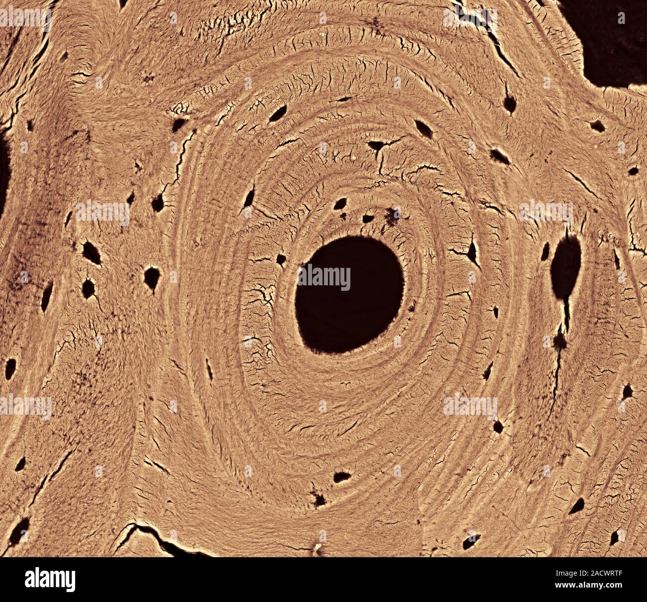 False-coloured Scanning Electron Micrograph of a cross-section through ...