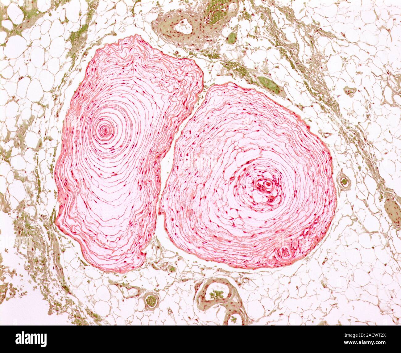 Touch receptors. Light micrograph of a section through two Pacinian ...