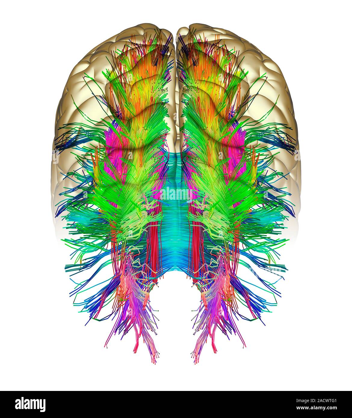 White matter fibres overlaid a 3d model of the human brain in top view ...
