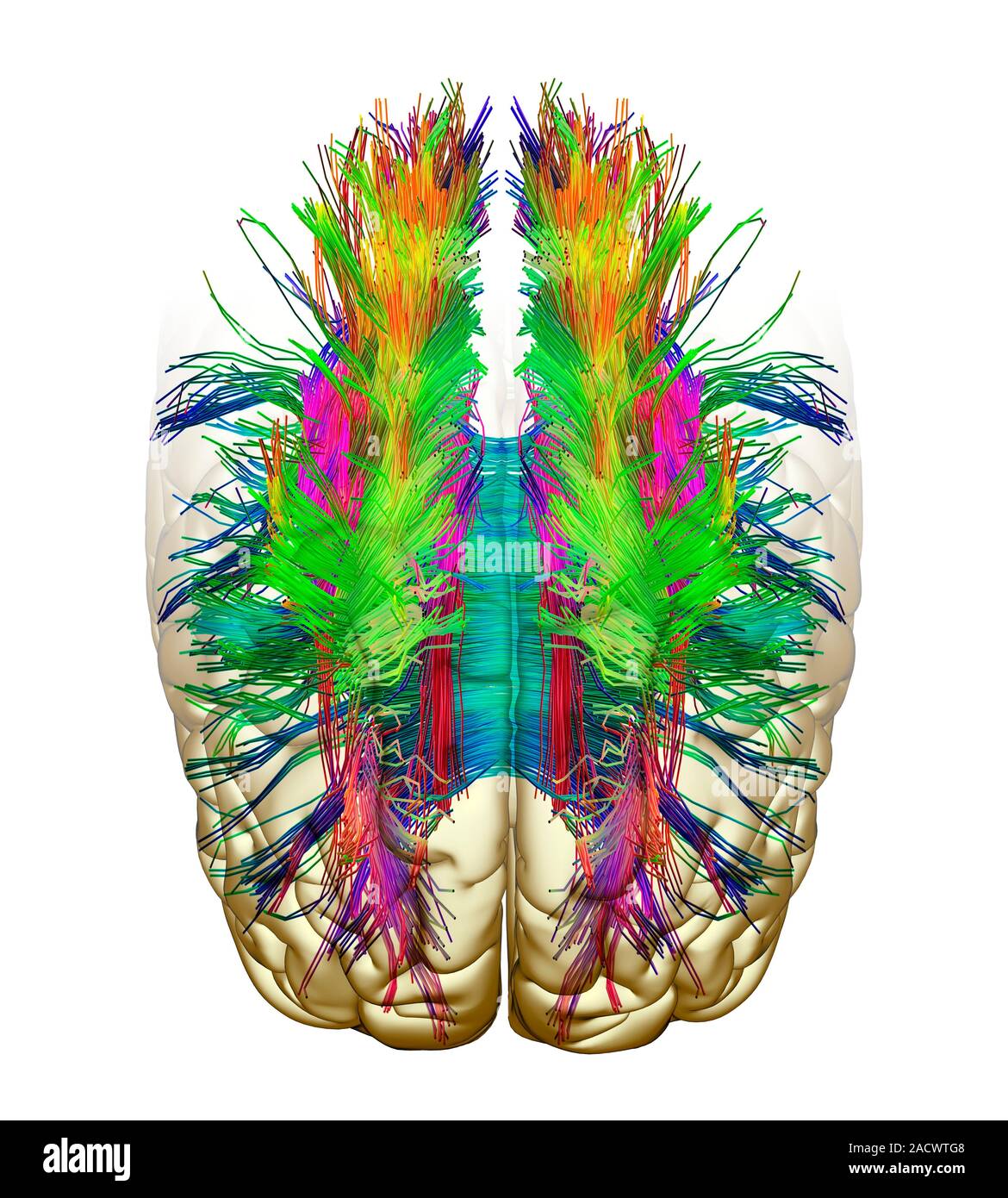 White matter fibres overlaid a 3d model of the human brain in top view ...