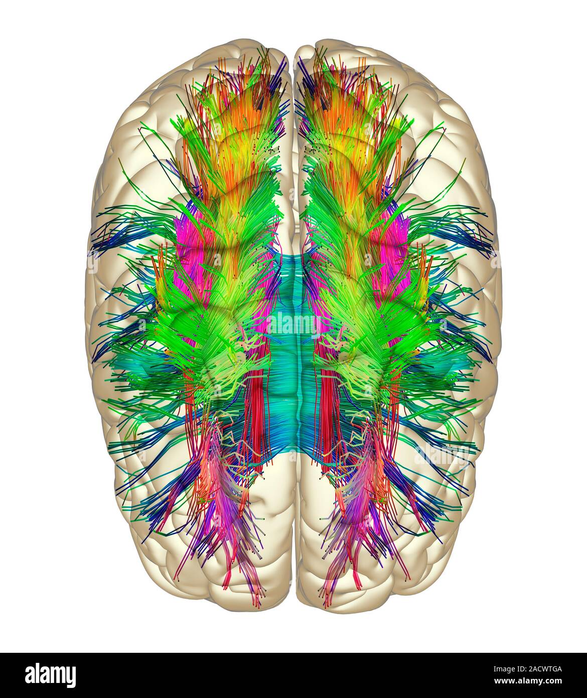 White matter fibres overlaid a 3d model of the human brain in top view ...