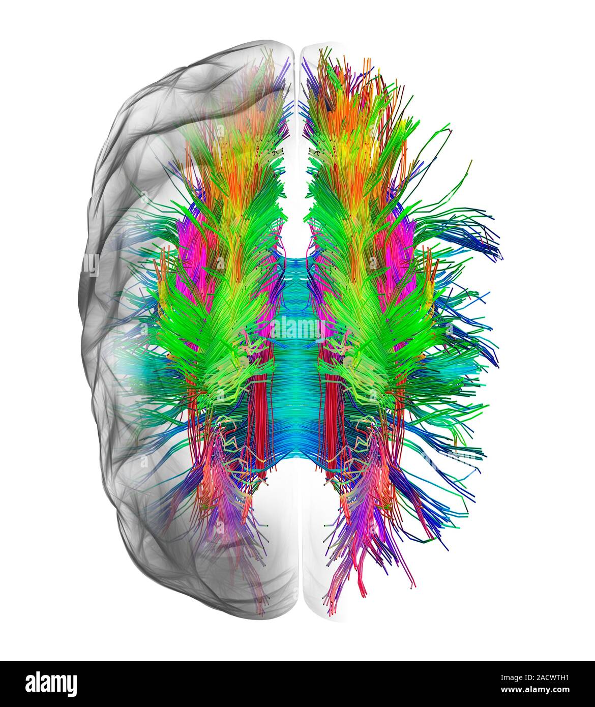 White matter fibres overlaid a 3d model of the human brain in top view ...