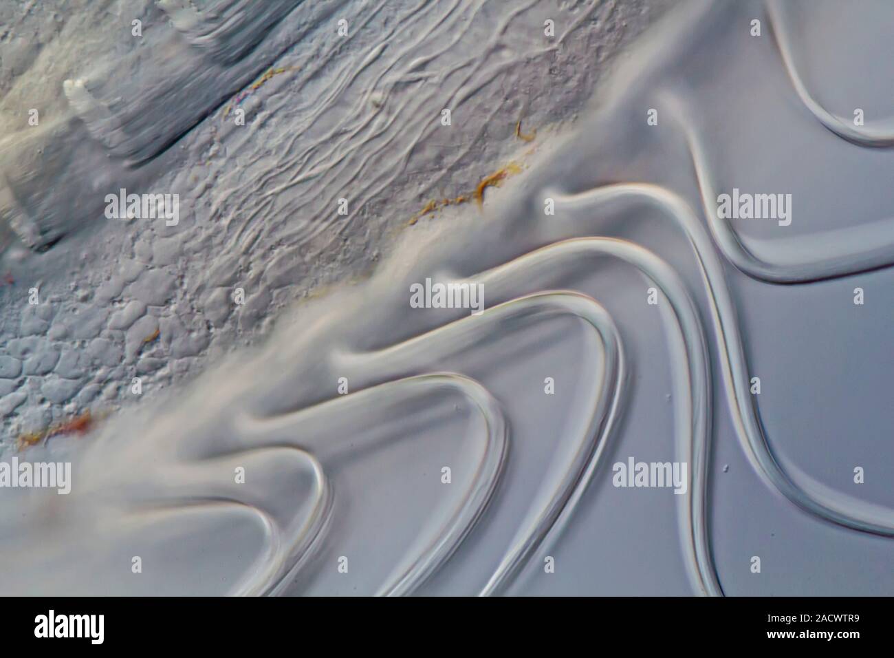 Light micrograph of a small species of sea gooseberry (Pleurobrachia sp ...