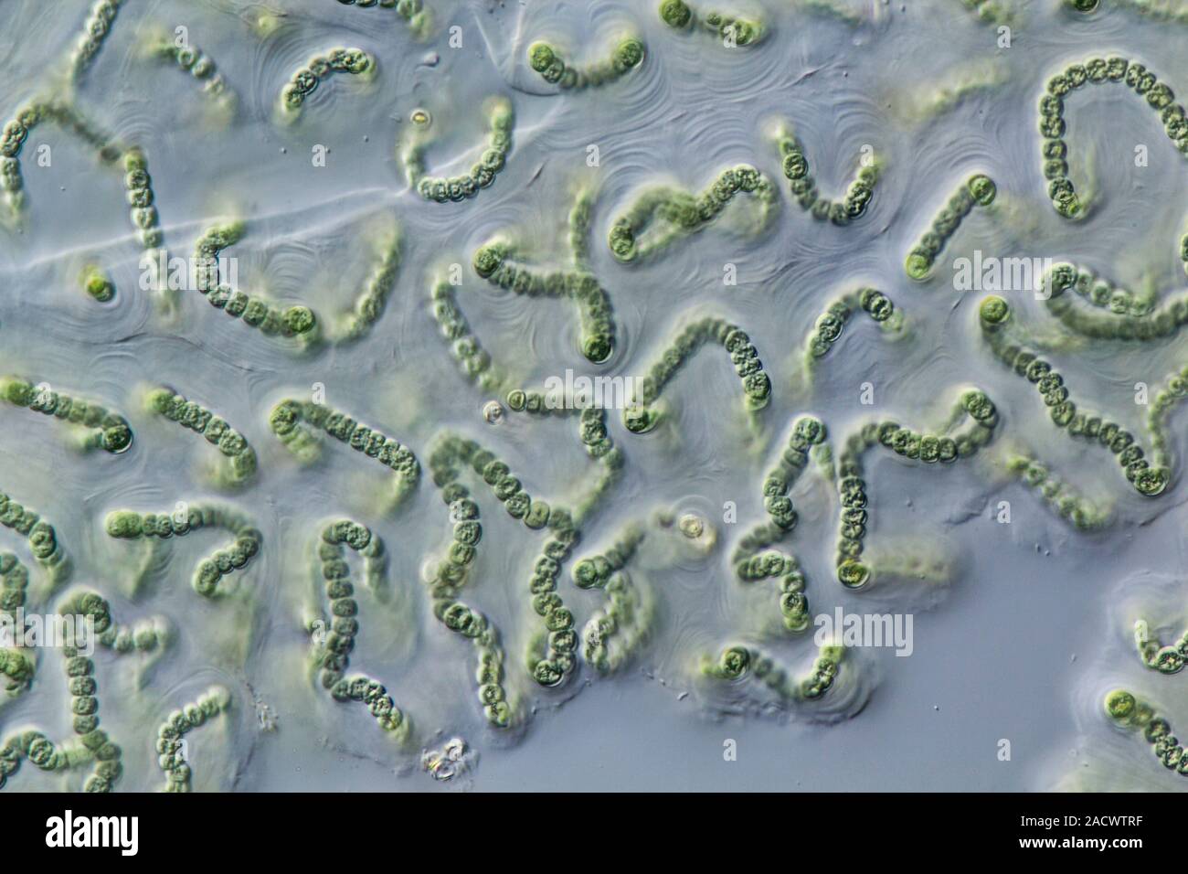 Light micrograph of Nostoc cyanobacteria, filaments of round cells ...