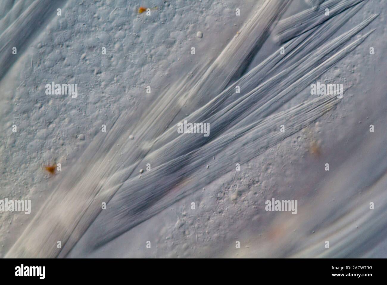Light micrograph of a small species of sea gooseberry (Pleurobrachia sp ...