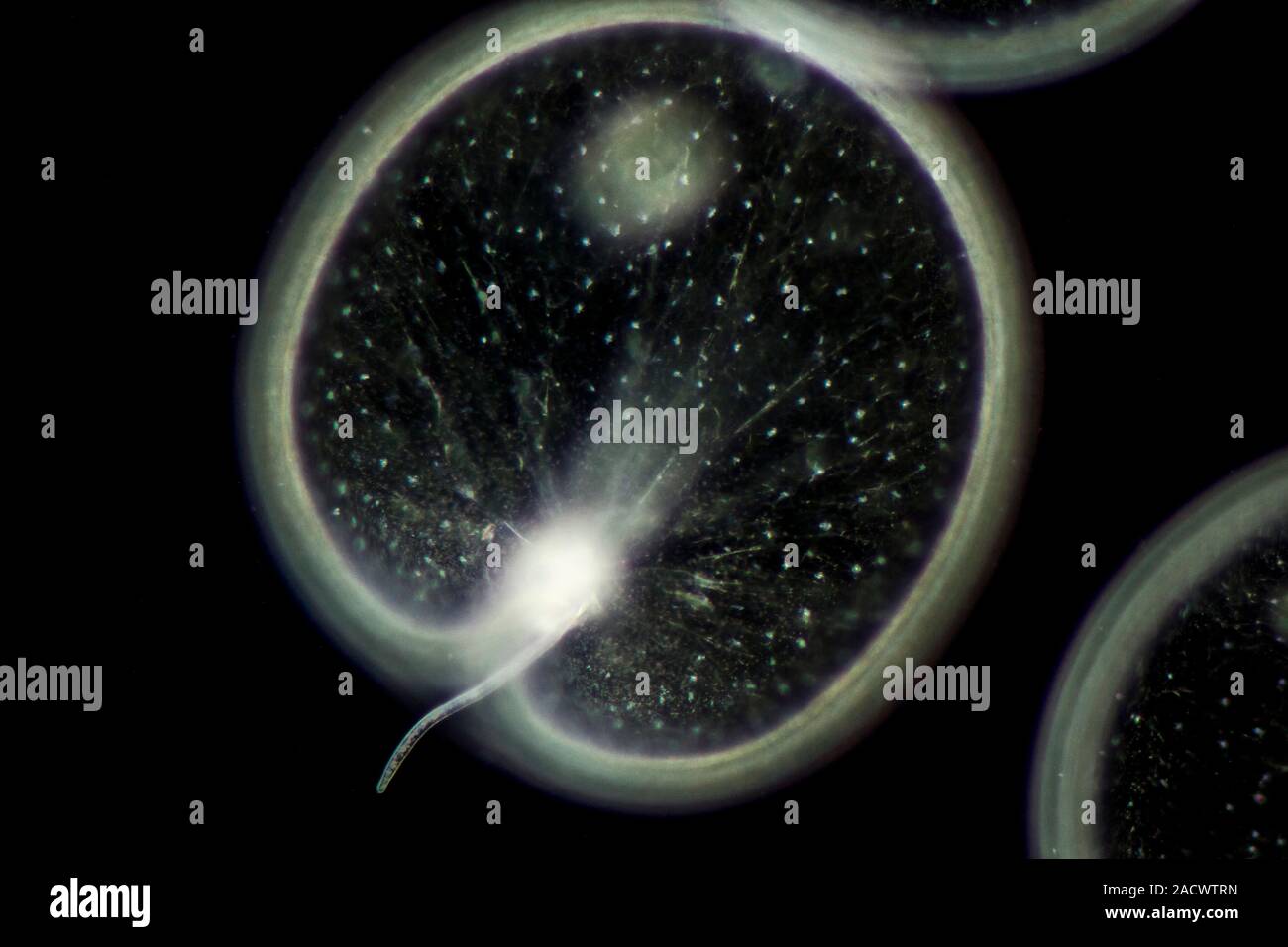 Light micrograph of Noctiluca scintillans, a large bladder-shaped ...