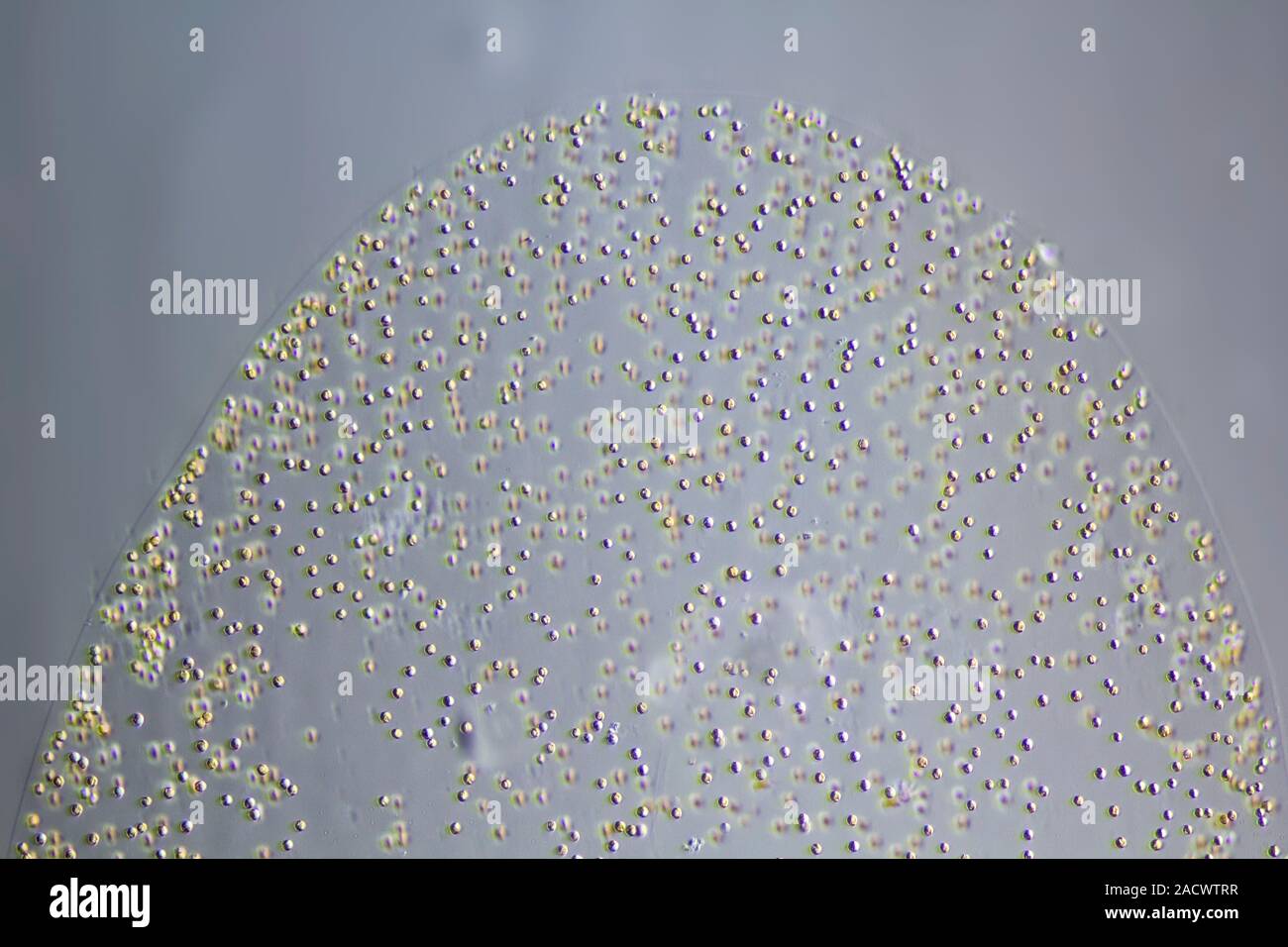Light micrograph of a Phaeocystis alga colony. These marine algae ...